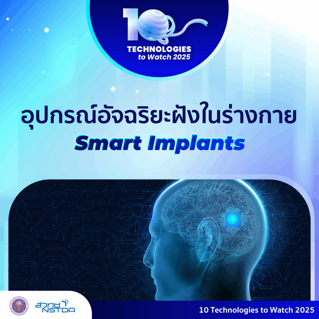 10 Technologies to Watch 2025: อุปกรณ์อัจฉริยะฝังในร่างกาย (Smart Implants) - NSTDA