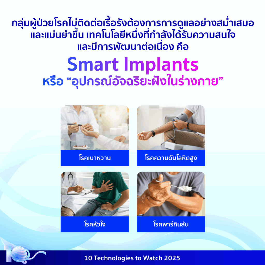 10 Technologies to Watch 2025: อุปกรณ์อัจฉริยะฝังในร่างกาย (Smart Implants) - NSTDA