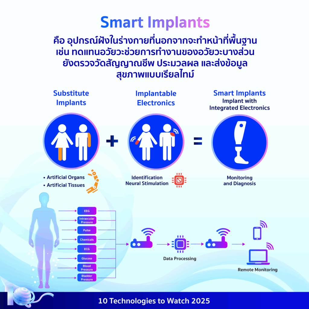 10 Technologies to Watch 2025: อุปกรณ์อัจฉริยะฝังในร่างกาย (Smart Implants) - NSTDA