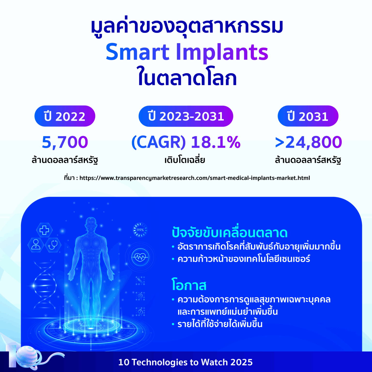 10 Technologies to Watch 2025: อุปกรณ์อัจฉริยะฝังในร่างกาย (Smart Implants) - NSTDA