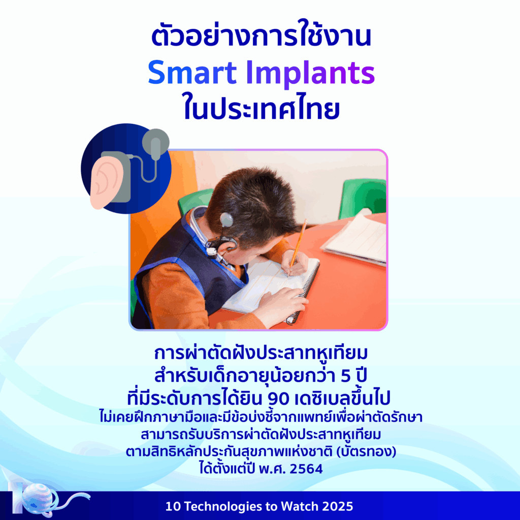 10 Technologies to Watch 2025: อุปกรณ์อัจฉริยะฝังในร่างกาย (Smart Implants) - NSTDA